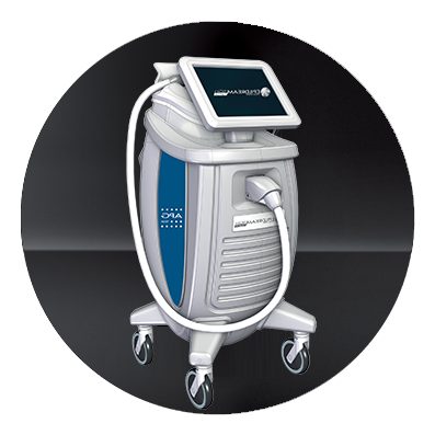 ShapInpulse - APG Tech